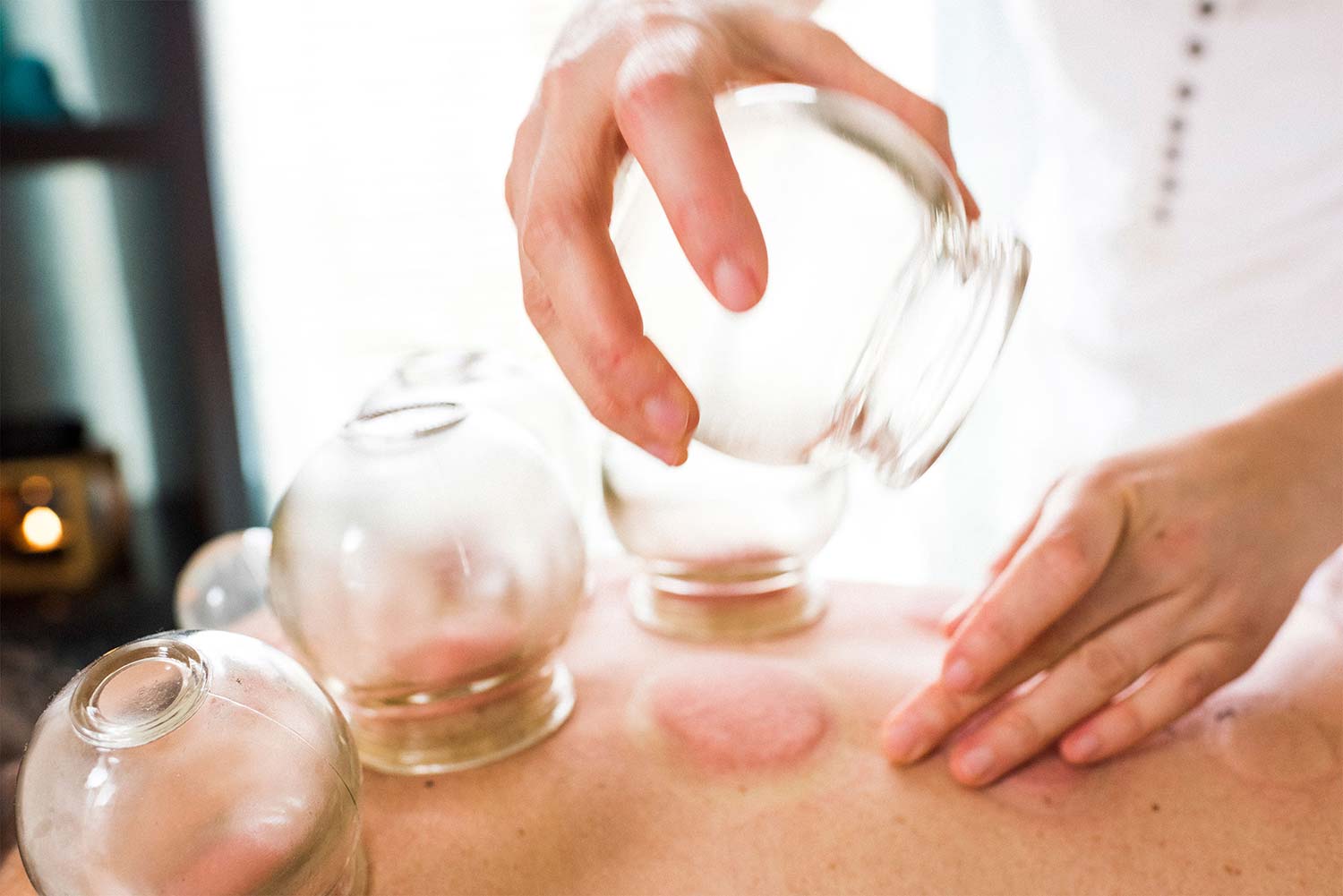 Cupping Acupuncture Herbal Medicine Union Square Park New York City